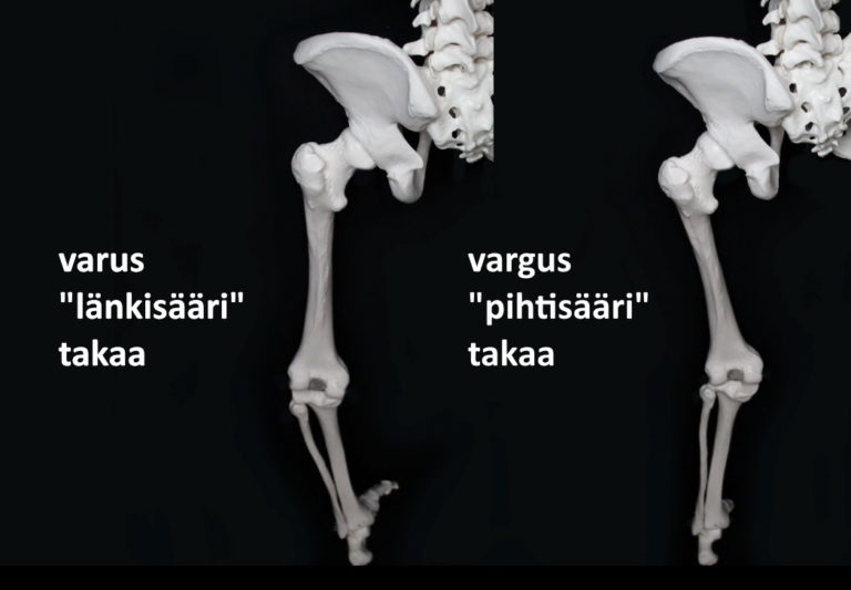 Polvikipu ja polven nivelrikko - Jalatja Healing - Jäsenkorjaus Tampere